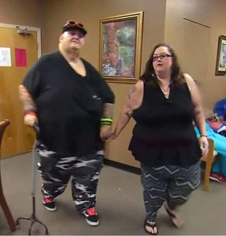 Obesidad mórbida antes y después - Sanibook